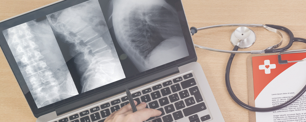 Caso de éxito en Teleradiología: la incursión en un centro de salud Caso de éxito en Teleradiología: la incursión en un centro de salud